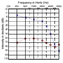 Hearing Aids Online | Lloyds Hearing Aids | Order Hearing Aids Online!